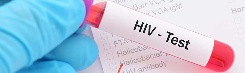 How HIV Is Transmitted | Canada Pharmacy