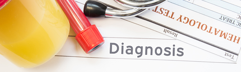 What to Do for Overactive Bladder | Canada Pharmacy